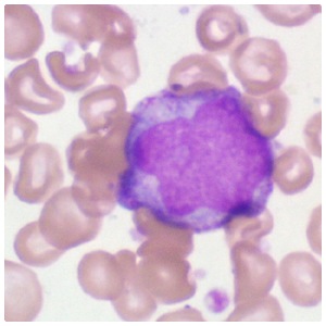 @Nãotemmaisfim@: Promielócitos